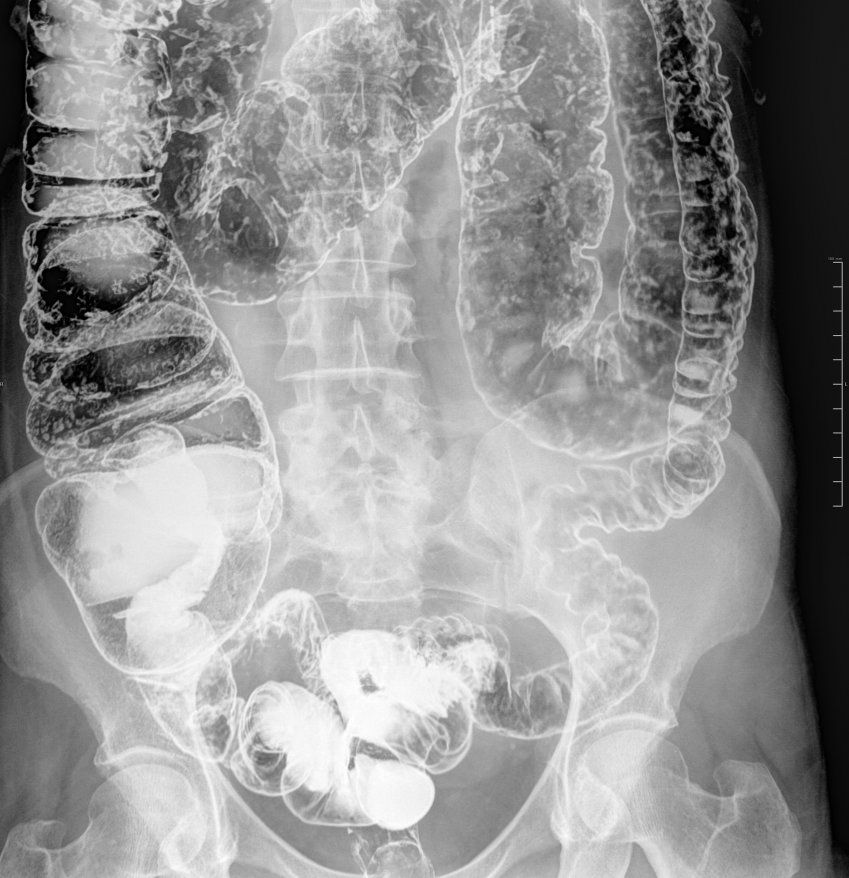 Contrastes | CLÍNICA DE RADIOLOGIA JULIO RAMBLA